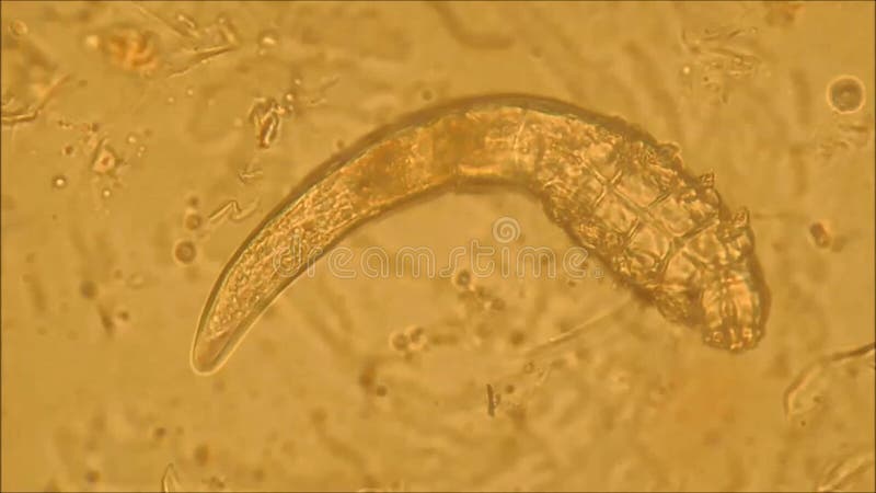 Itching Under Plaster Bandage. Woman Scratches Broken Leg, Close-up ...