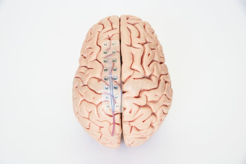 Subdural Grid Electrode for Brain Waves Recording on the Brain Model ...