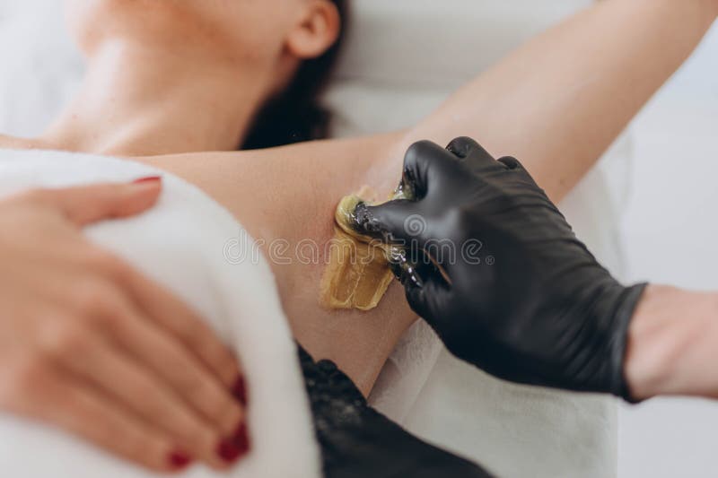 Sugaring: Epilation with Liquate Sugar at Armpit. Stock Image - Image ... Sugaring: Epilation with Liquate Sugar at Armpit. Stock Image - Image ...