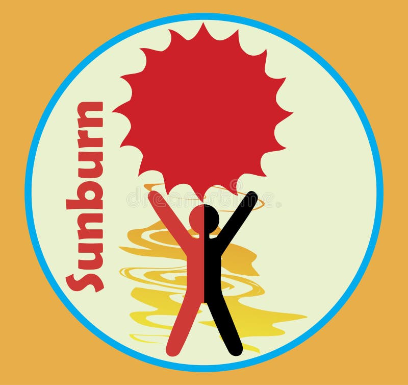 Sunburn stock vector. Illustration of skin, tight, protection - 35777464