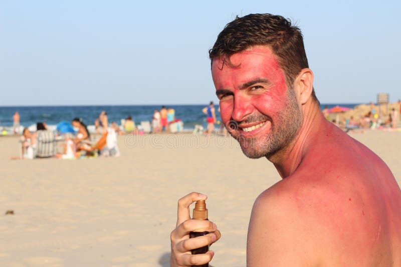 2,267 Sunburned Stock Photos - Free & Royalty-Free Stock Photos from ...