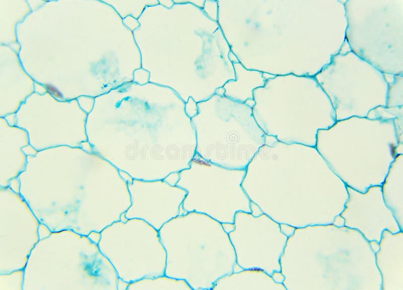 Sunflower Stalk Cross-section Under the Microscope, (Helianthus Stock ...