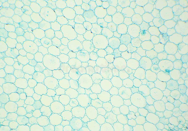 Sunflower Stalk Cross-section Under the Microscope, (Helianthus Stock ...