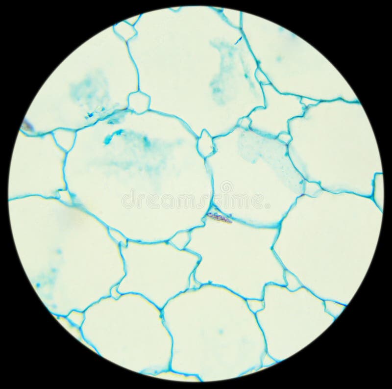 Sunflower Stalk Cross-section Under the Microscope, (Helianthus Stock ...
