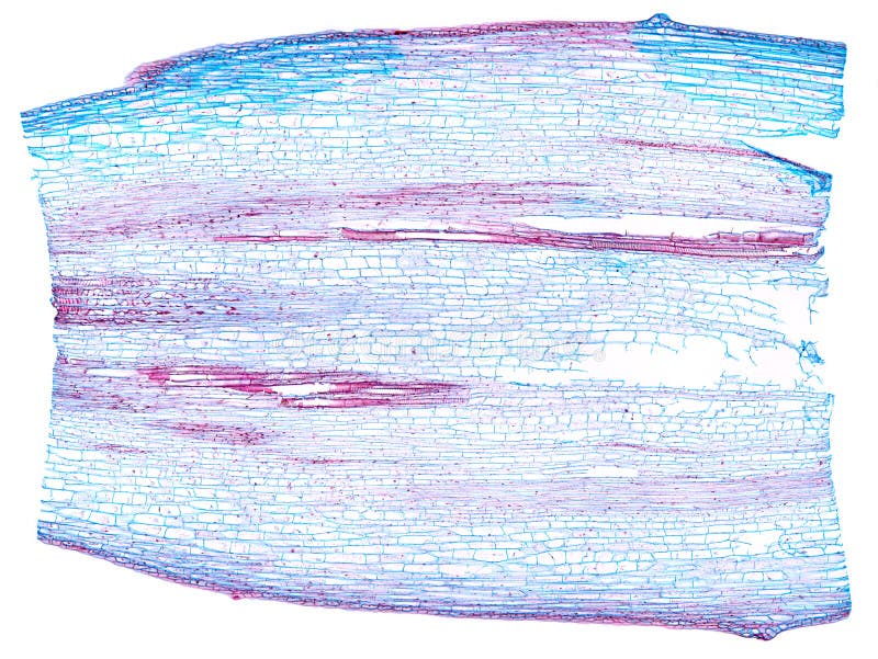 Longitudinal Section Of A Stem
