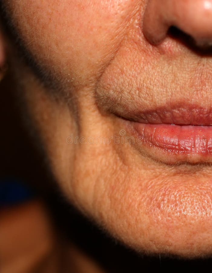 Sunken Cheeks. Nasolabial Folds on Face. Wrinkles. Stock Image - Image ...