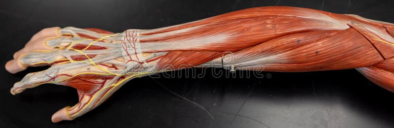 Superficial Forearm Dissection Focused on Wrist Extensor Muscles Stock ...