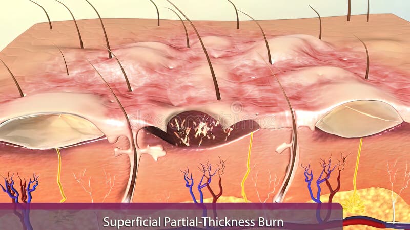 Partial Muscle Stock Illustrations – 27 Partial Muscle Stock ...