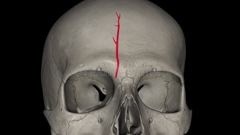 The Supratrochlear Artery (or Frontal Artery) is One of the Terminal ...