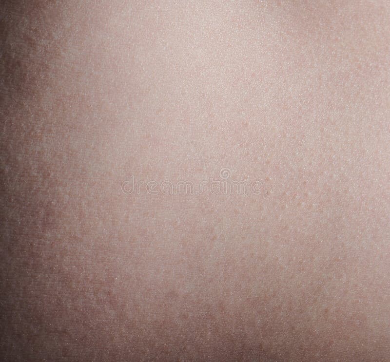 Surface of Human Skin Background Stock Photo - Image of pattern, health ...