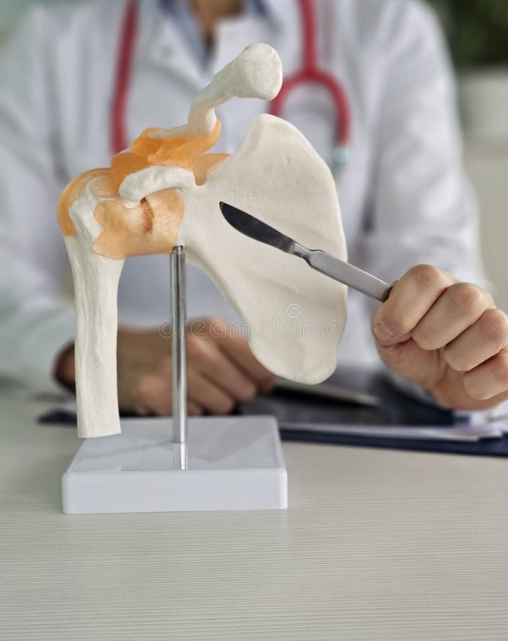 Surgeon and Anatomy of Shoulder and Scalpel Concept. Shoulder Surgery ...