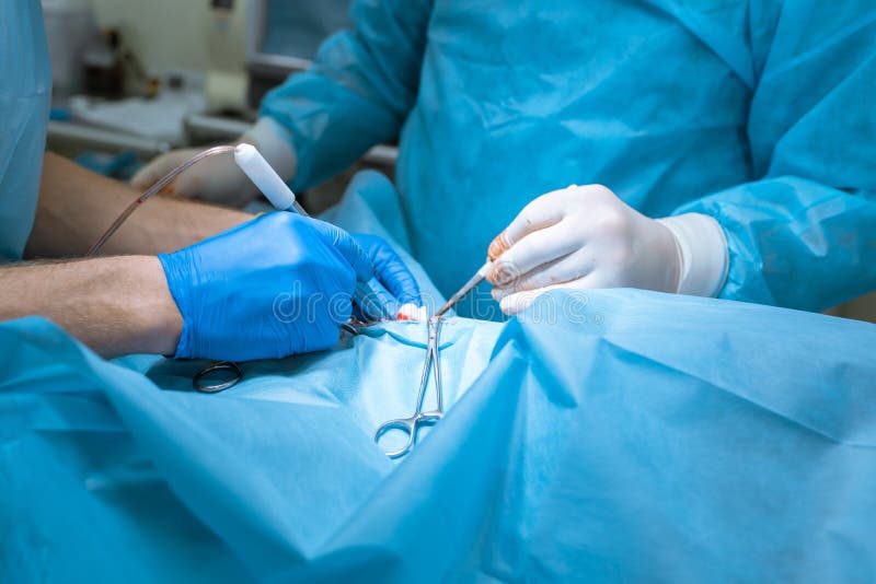 The Surgeon Applies a Surgical Clamp To Stop the Bleeding. Group of ...