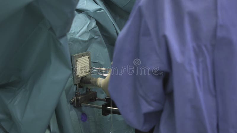 Invasive Installation Stock Photos - Free & Royalty-Free Stock Photos ...