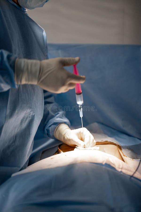 Surgeon Makes an Injection during an Operation Stock Image - Image of ...