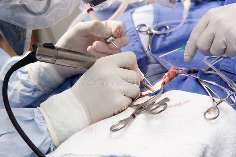 Minimally invasive surgery stock photo. Image of minimally - 1156822