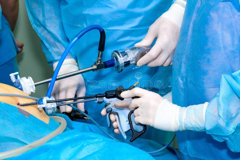 Laparoscopic Surgery Hemorrhoids Stock Photos - Free & Royalty-Free ...