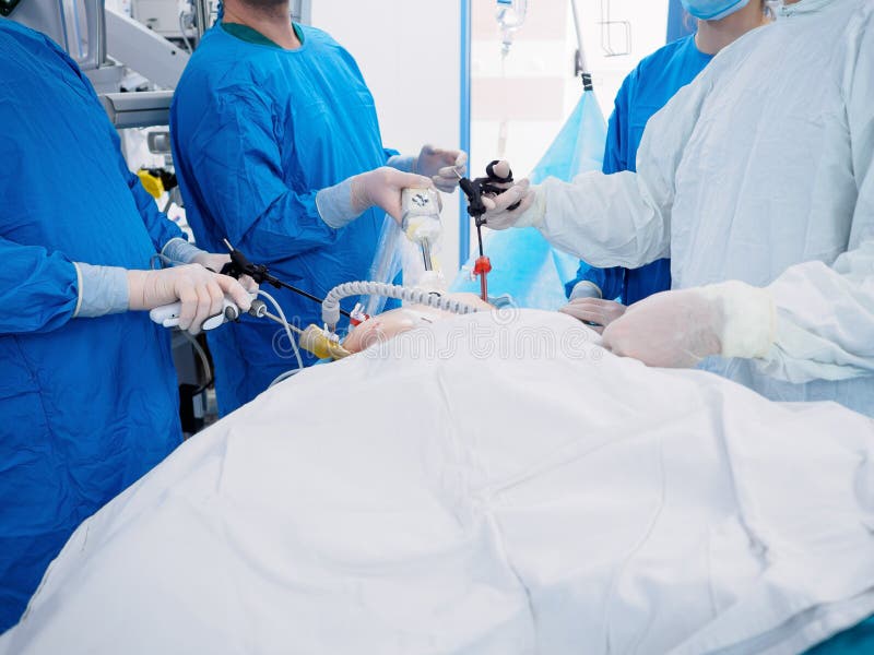 Surgeons in Blue Uniforms Perform Laparoscopic Surgery Using Special ...