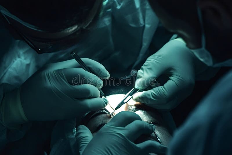 Surgeons Performing Delicate Eye Surgery with Precision Instruments ...