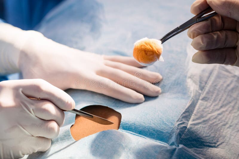 Surgeons Performing Operation in Operation Room Stock Image - Image of ...