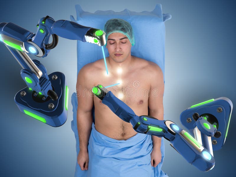 The Surgery Performed by Robotic Arm Stock Image - Image of endoscopy ... The Surgery Performed by Robotic Arm Stock Image - Image of endoscopy ...