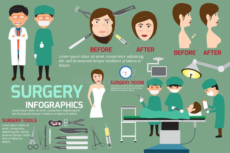 Surgery Poster Infographics Elements, Health and Medical. Stock Vector ...