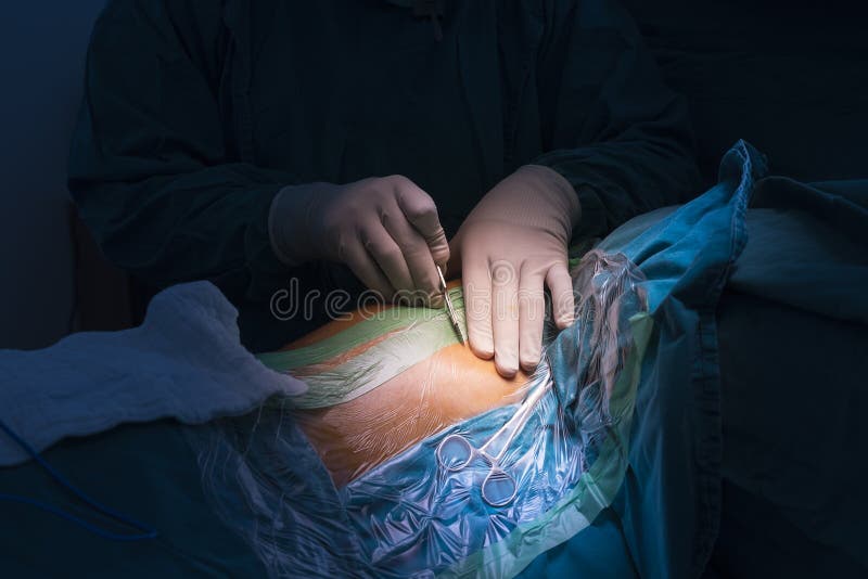 Incision stock image. Image of opening, medical, incision - 41064877