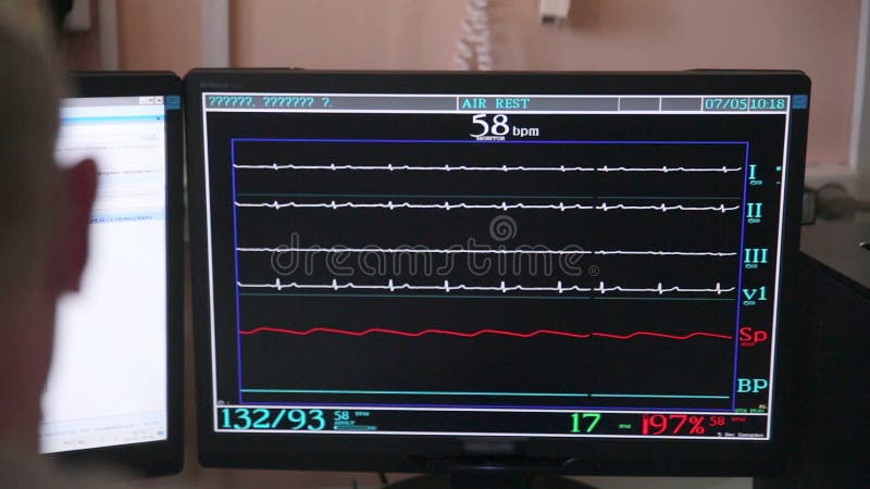 Surgery. Unrecognizable Doctor Controls Operation Performing in ...