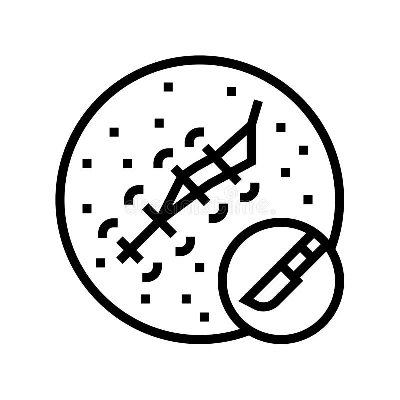 Surgical Excision Mole Removal Line Icon Vector Illustration Stock ... Surgical Excision Mole Removal Line Icon Vector Illustration Stock ...