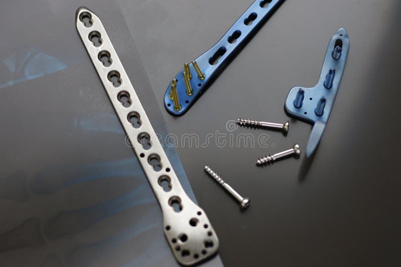 Surgical Instruments in Traumatology for Osteosynthesis of Bone ...