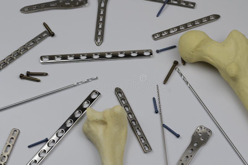 Surgical Instruments in Traumatology for Osteosynthesis of Bone Fracture Stock Photo - Image of ...