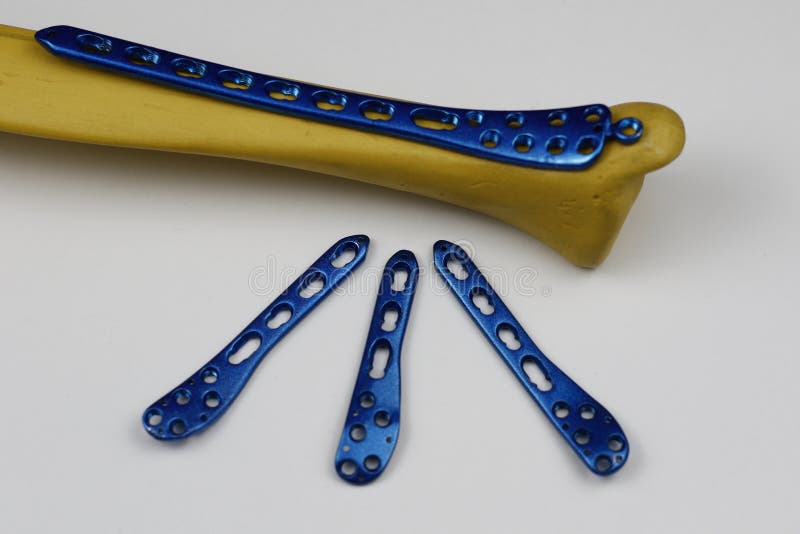 Surgical Instruments in Traumatology for Osteosynthesis of Bone ...