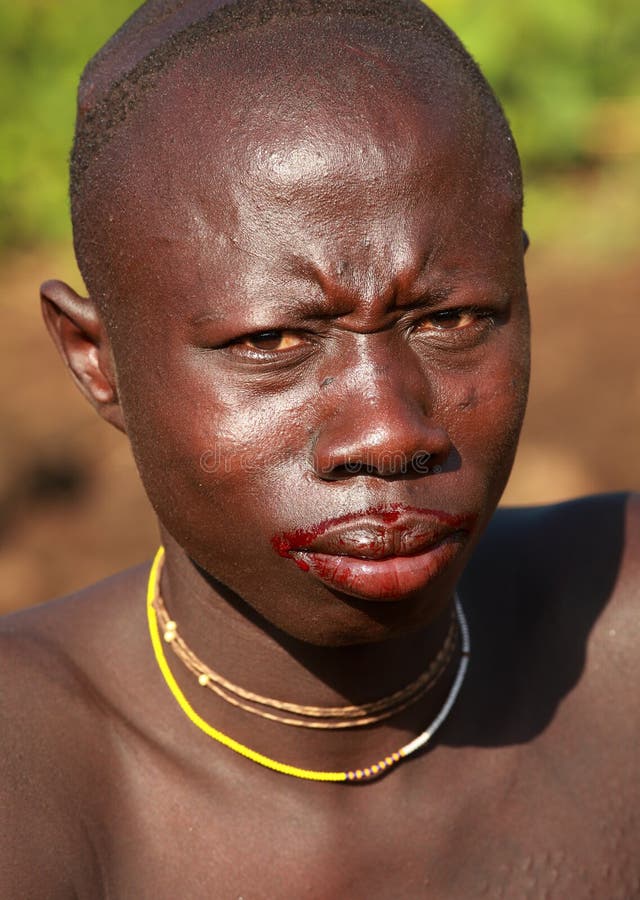 Suri woman with lipplate editorial photography. Image of ethnic - 34930372