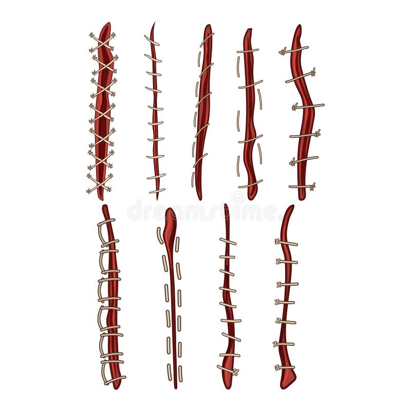 Suture Sign Stock Illustrations – 313 Suture Sign Stock Illustrations ...