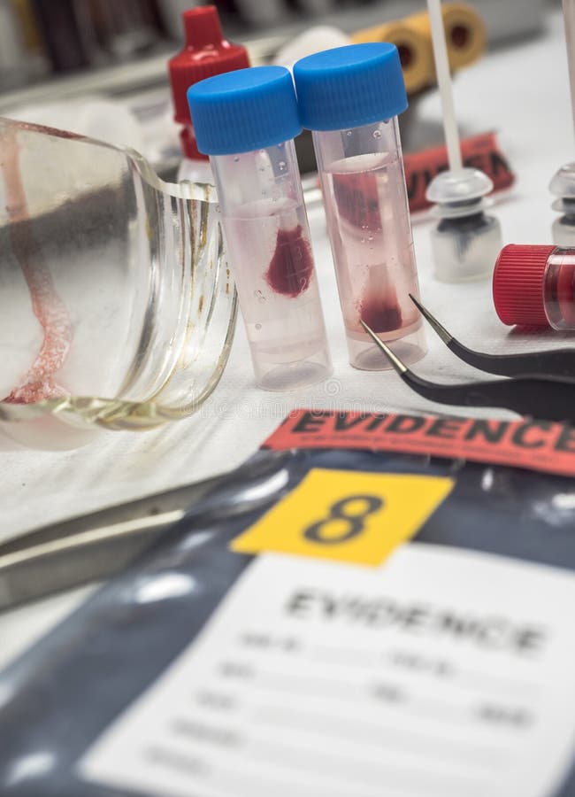 Swabs with Blood Sample To Be Analyzed in the Laboratory Stock Photo ...