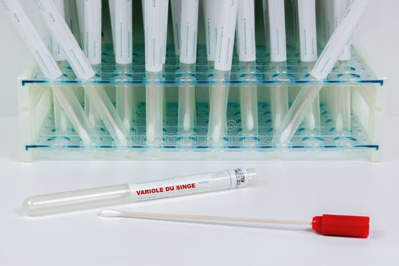 PCR Test for Monkeypox Detection. Stock Photo - Image of virus ...