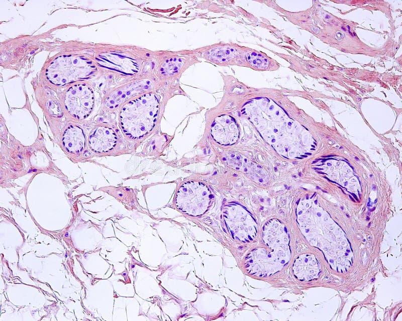 Sweat Gland. Secretory Unit. Mallory PTAH Stain Stock Photo - Image of ...