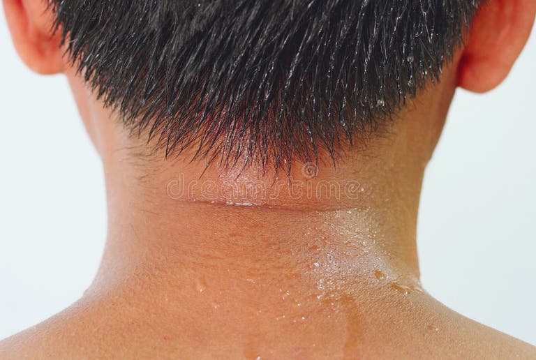 Sweat on the neck stock image. Image of complexion, cream - 79349585