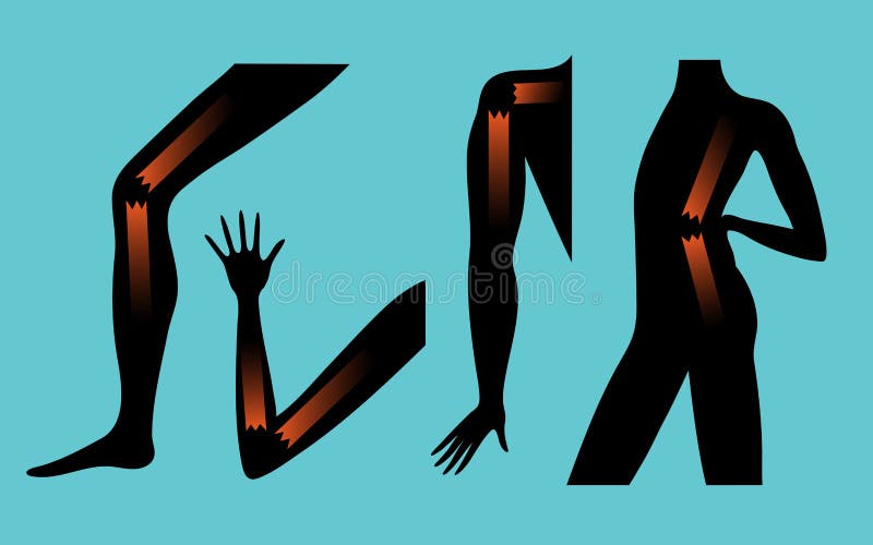 Symbol of Illness and Problems in the Joints of the Arm, Leg, Back of ...