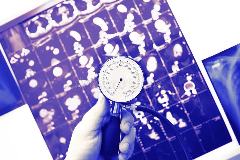 Medical Examination Results on the Background of Technicall Equipped ...