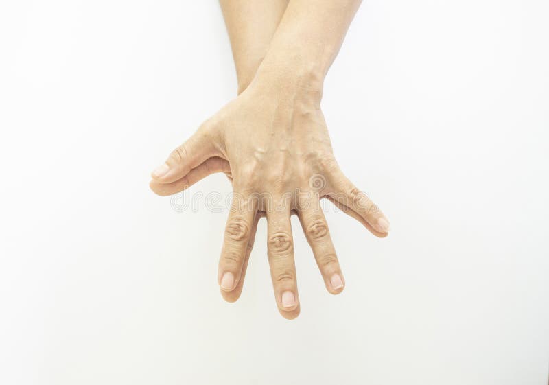 Symptom of a Person S Hand and Finger Stock Photo - Image of gesture ...