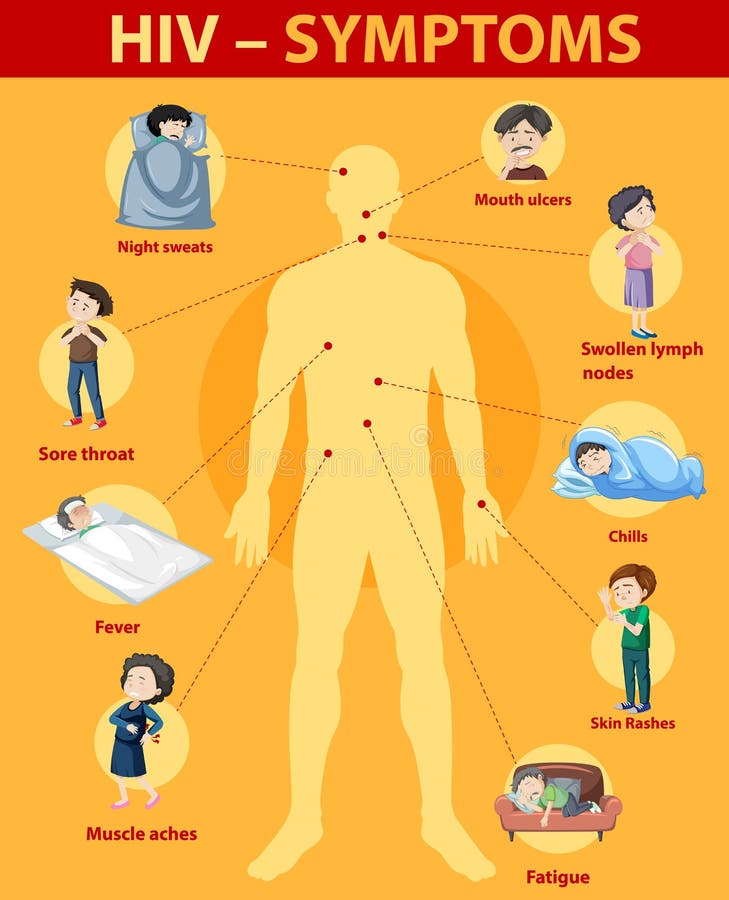 Symptoms Of Hiv Infection Infographic Stock Vector Illustration Of