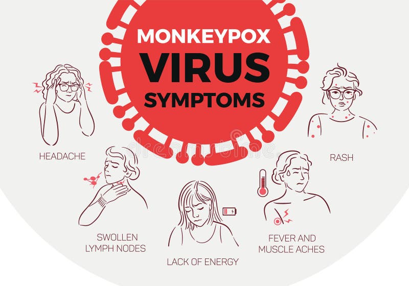 Symptoms of Monkeypox. Detailed Visual Representation of Disease is ...