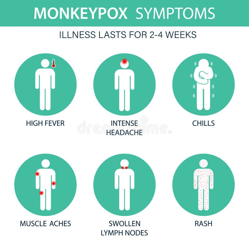 Symptoms of the Monkeypox Virus. Symptoms of the Monkeypox Virus. Stock ...