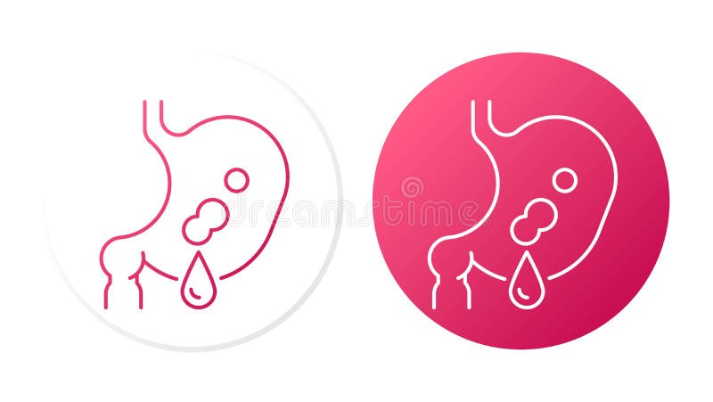 Peptic Ulcer Symptoms Stock Illustrations – 77 Peptic Ulcer Symptoms ...