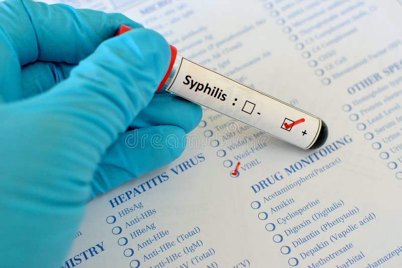 Syphilis positive stock photo. Image of patient, syphilis - 55774806