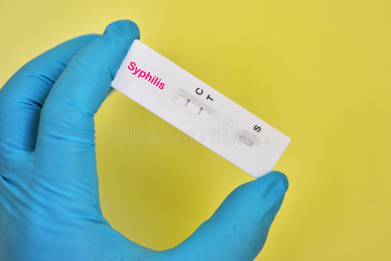 Syphilis Positive Test Result Stock Image - Image of serum, device ...
