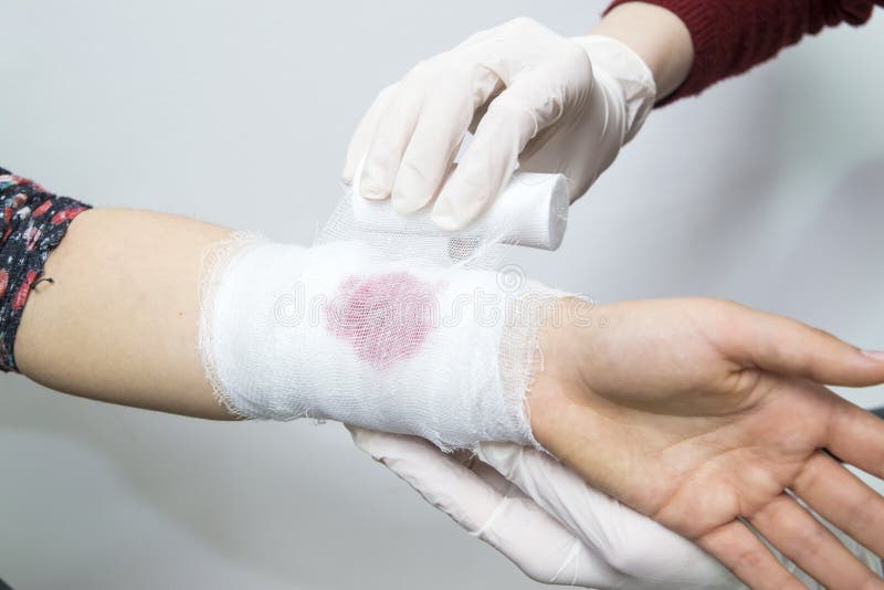 Técnicas de ligaduras imagem de stock. Imagem de salvamento - 40761317