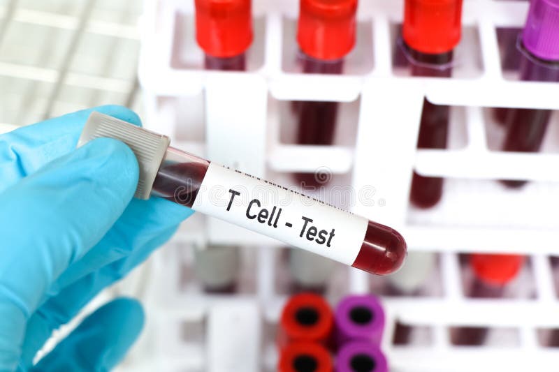 T Cell - Test, Blood Sample To Analyze in the Laboratory Stock Image ...