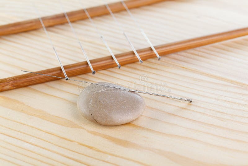 Table with Needles for Acupuncture. Silver Needles for Traditional ...