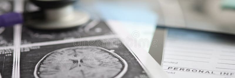 On Table is Photograph with Results of Brain Examination. Stock Photo ...